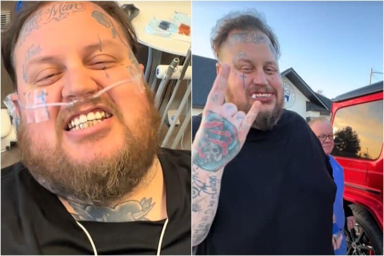 See Inside The Journey Of Jelly Roll's Mouth Transformation - Country Now